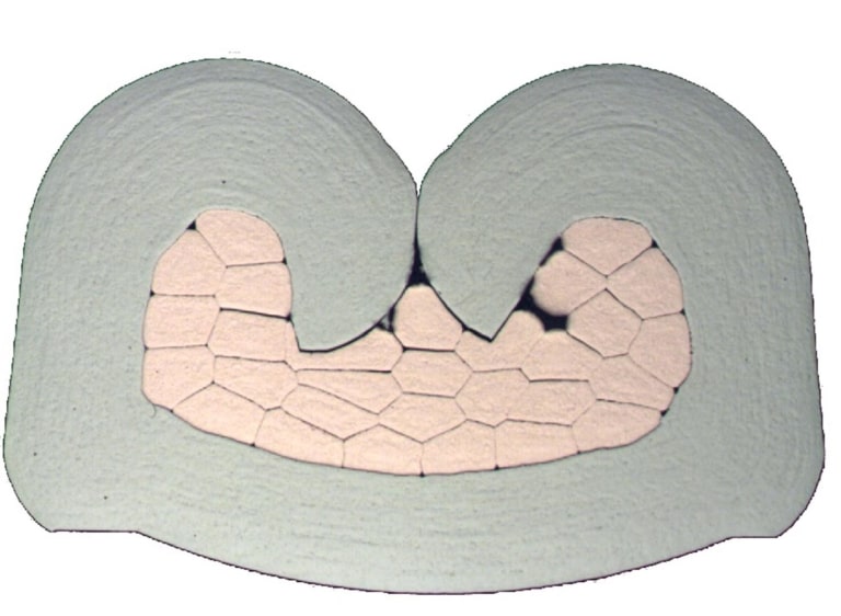 Crimp cross section analysis - Claravision